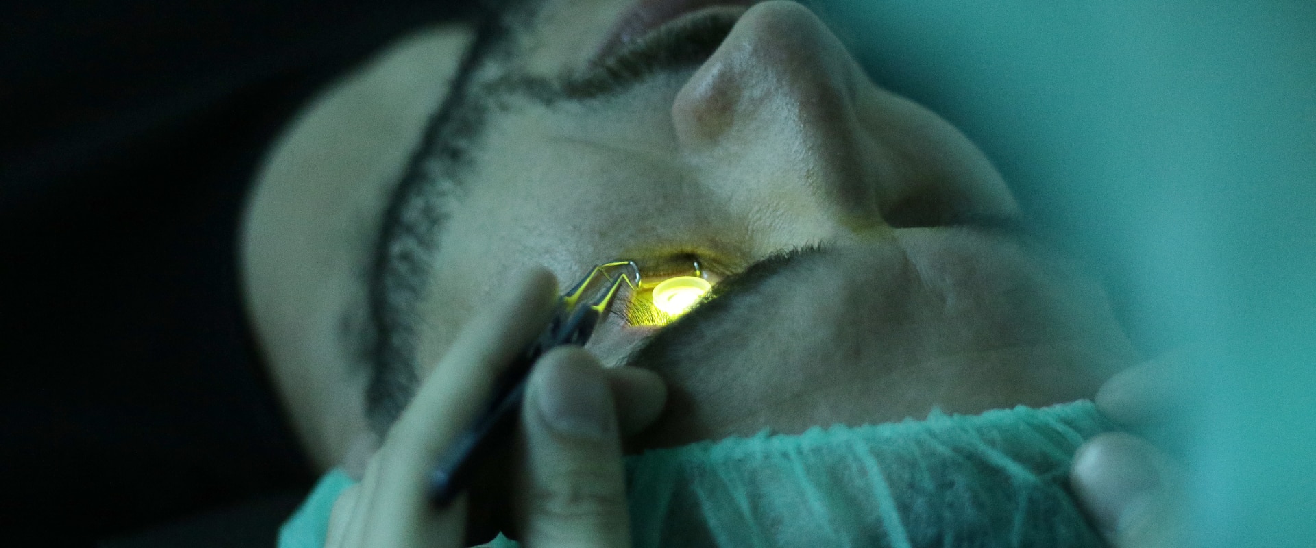 Cross linking corneal: ¿cuándo se recomienda? | Futuro Visión