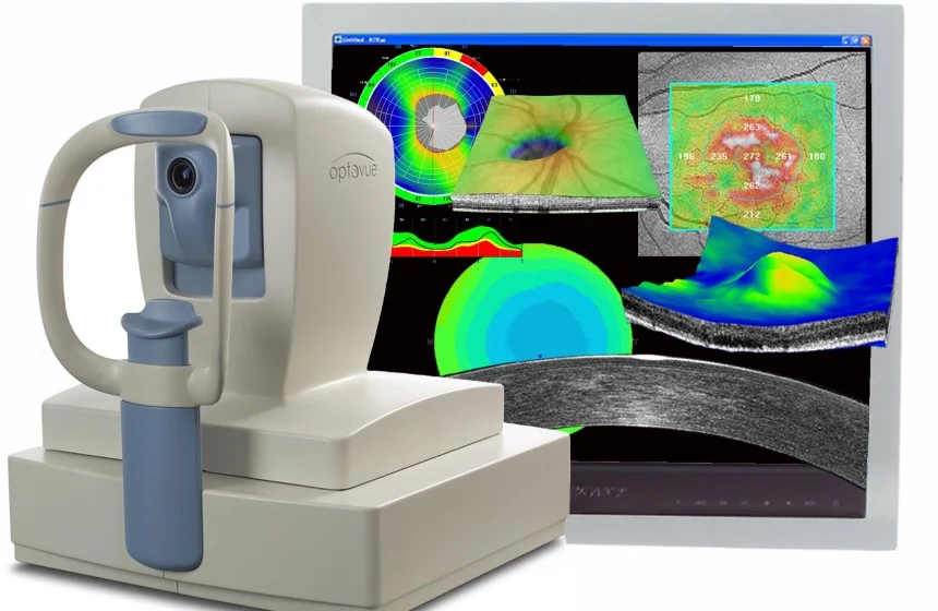 Medida de la vista: aprende cómo leer tu receta | Futuro Visión